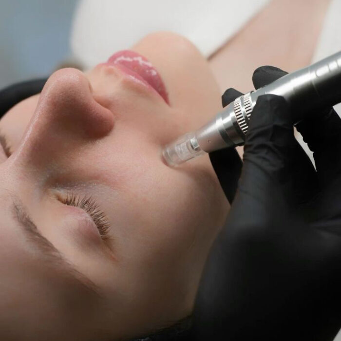 Salmon PDRN Skin Renewal Therapy - Sumi Skin